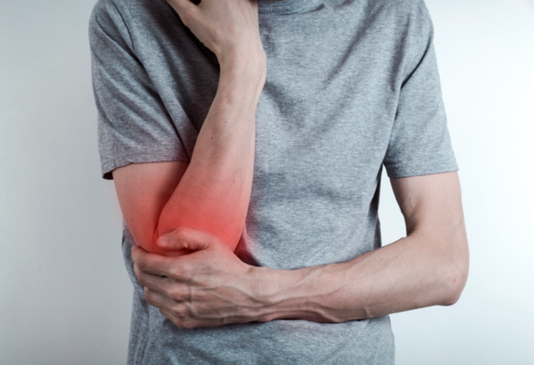 Douleur au coude : épicondylite ou épitrochléite